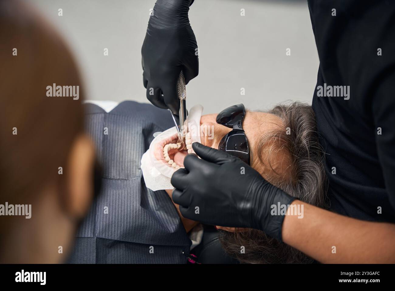Surgeon with help of assistant removes tooth from elderly lady Stock ...