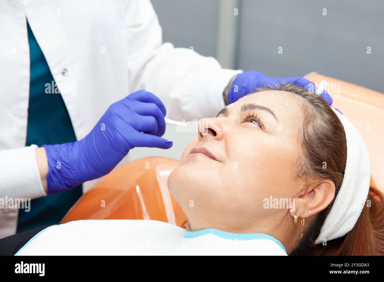 Dermatologist marking of injection points for botulinum toxin ...