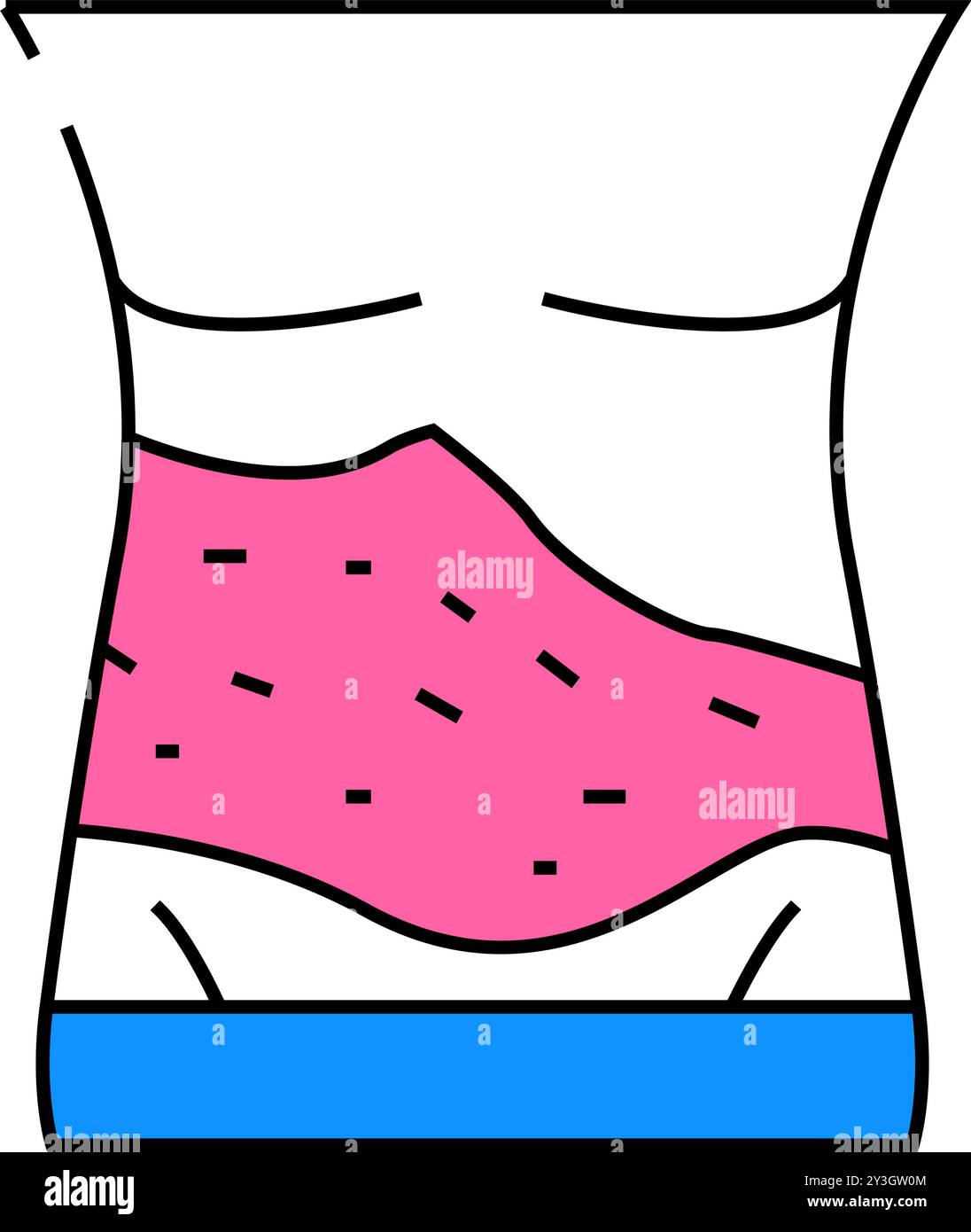 shingles skin disease icon color illustration Stock Vector Image & Art ...