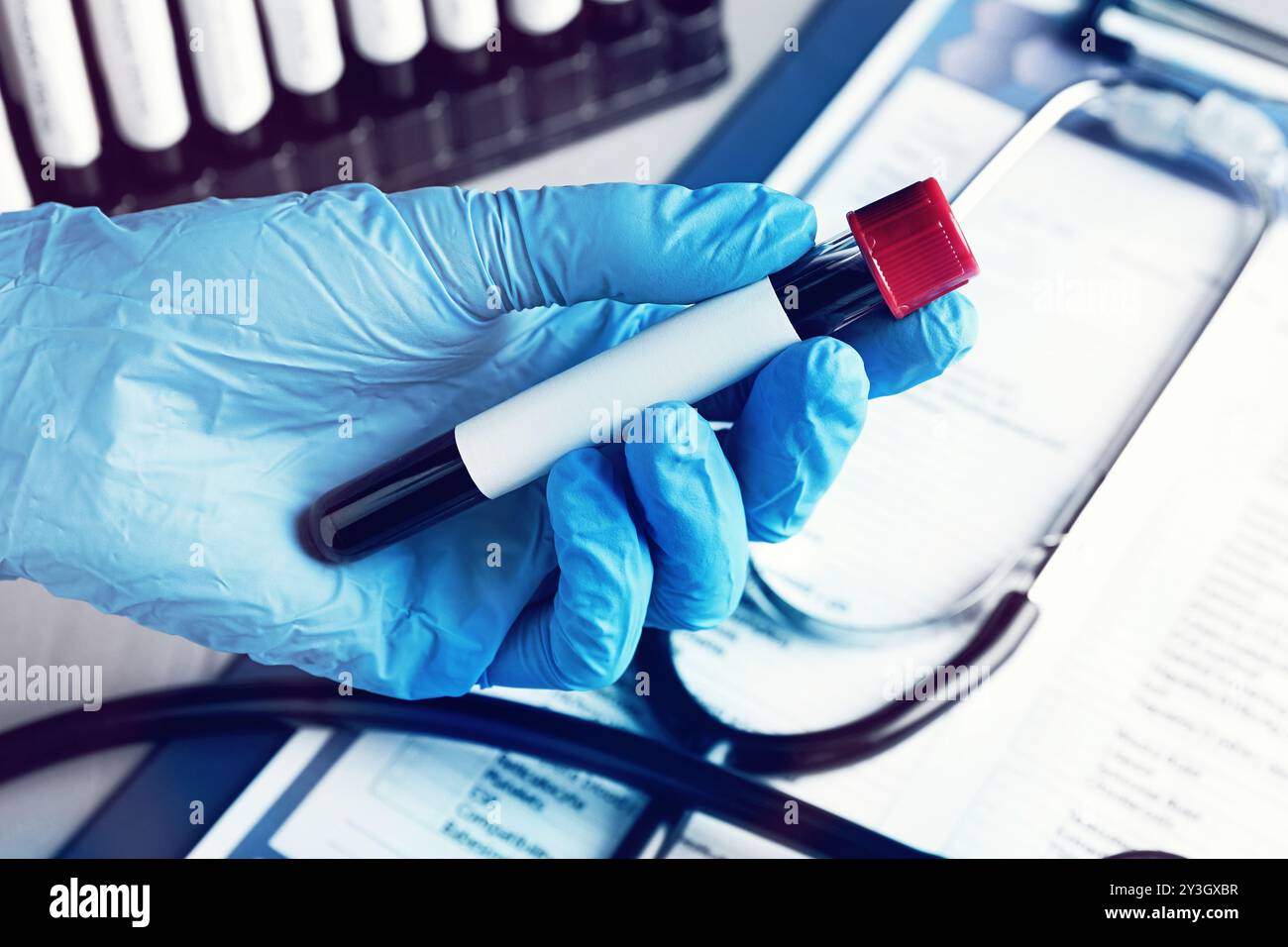 Laboratory worker holding test tube with blood and blank label over ...