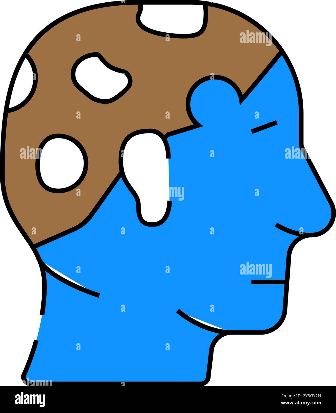 alopecia areata icon color illustration Stock Vector Image & Art - Alamy
