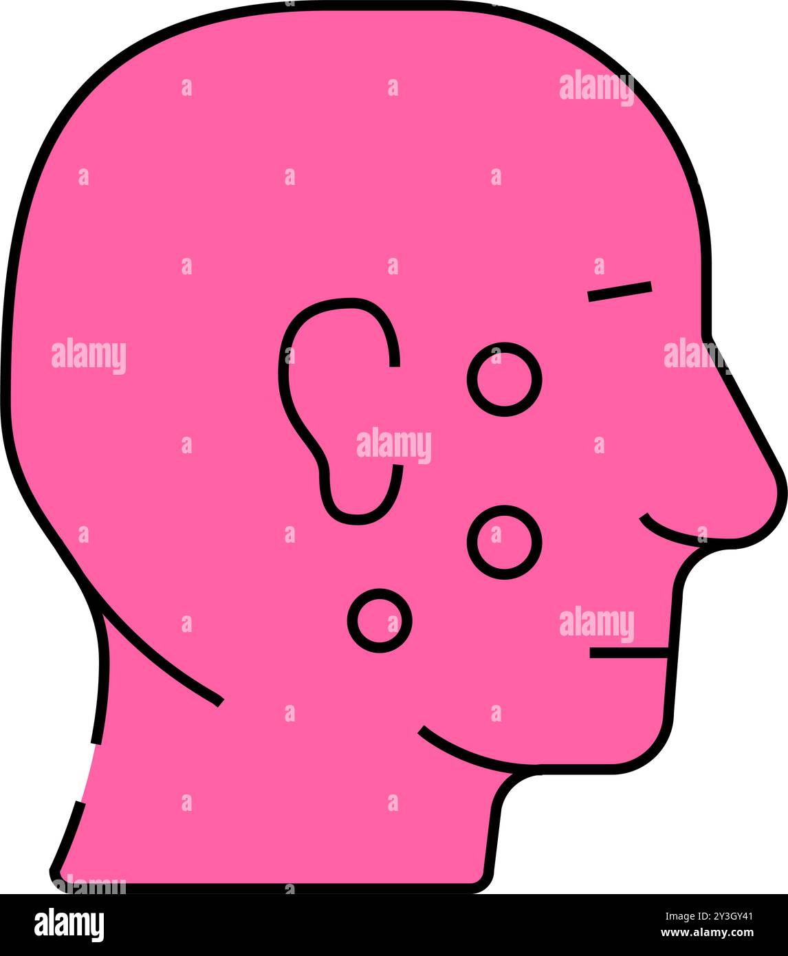 acne facial skin disease icon color illustration Stock Vector Image ...