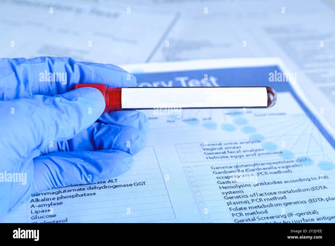Pregnancy test lab analysis hi-res stock photography and images - Alamy