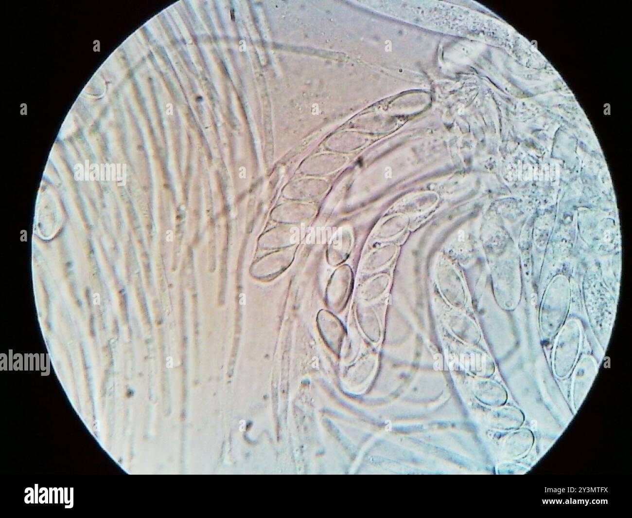 (Ascobolus crenulatus) Fungi Stock Photo - Alamy