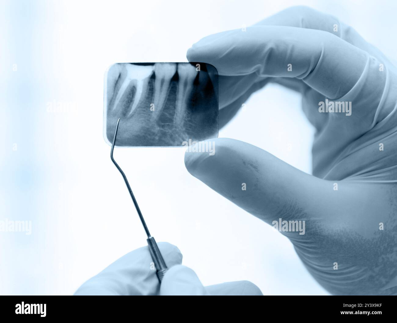 Tooth x-ray being examined by a dentist Stock Photo - Alamy