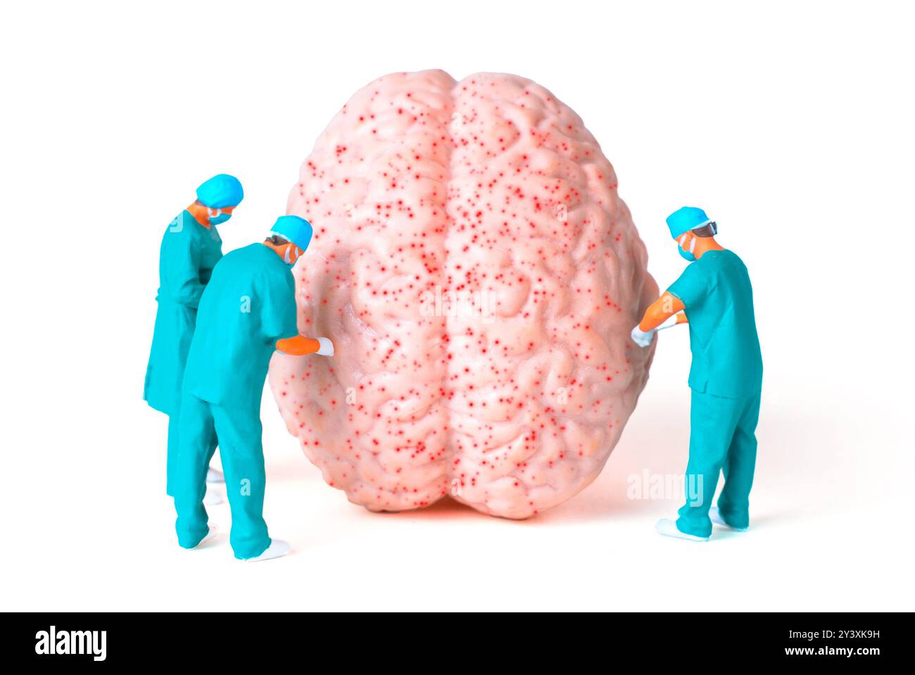 Miniature surgeons examining a large brain model with red spots ...