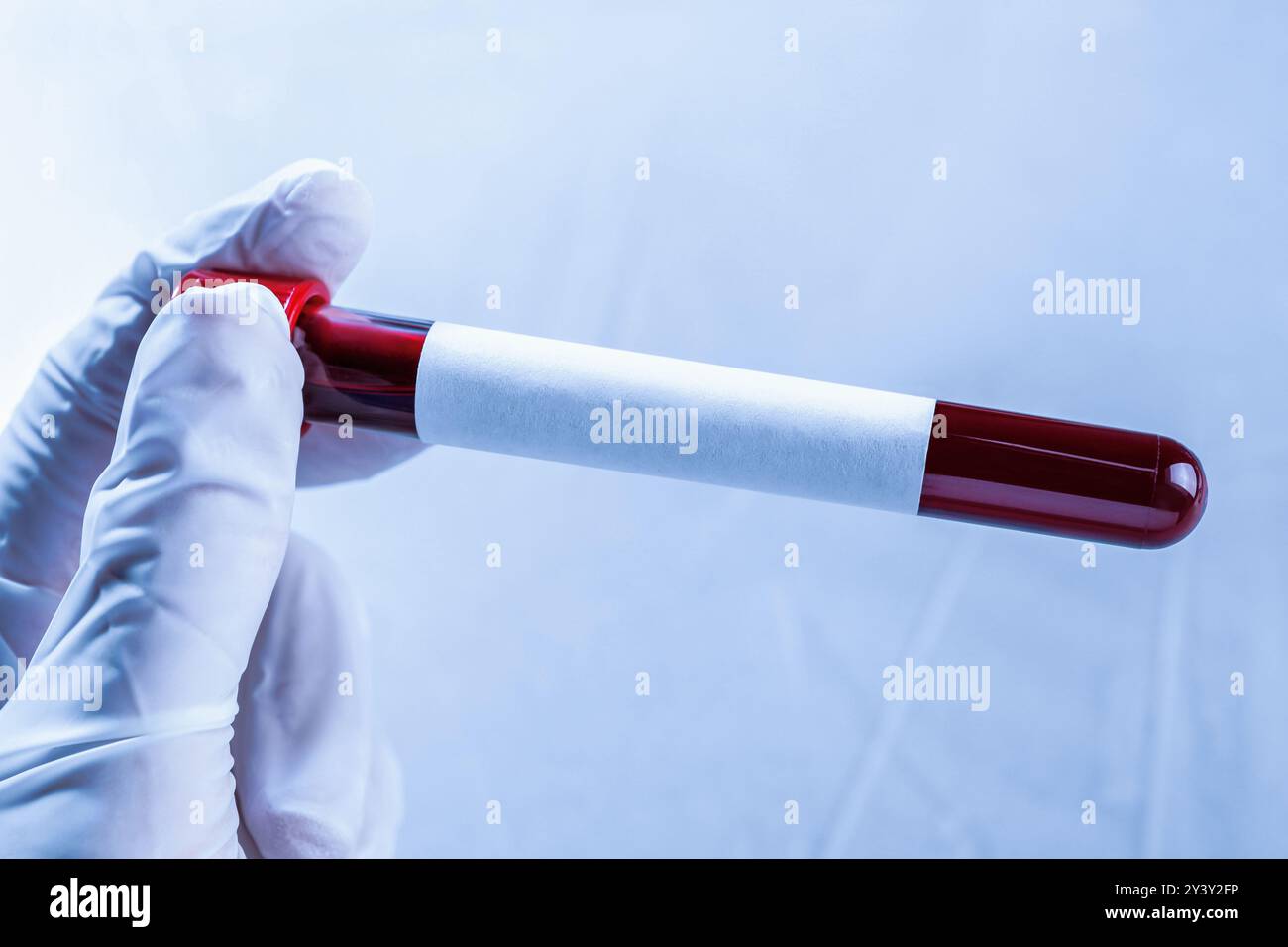 Laboratory worker holding test tube with blood sample and blank label ...