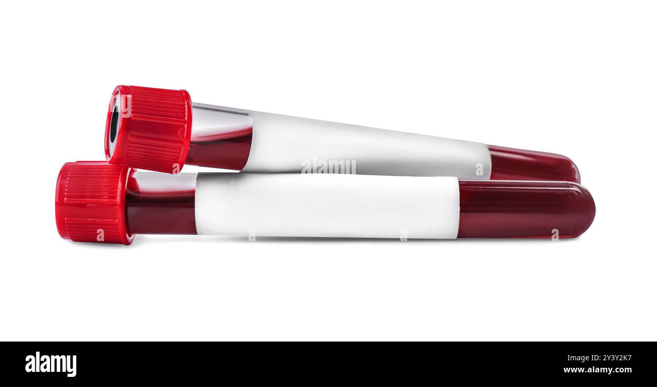 Blood in test tubes with blank labels on white background. Medical ...