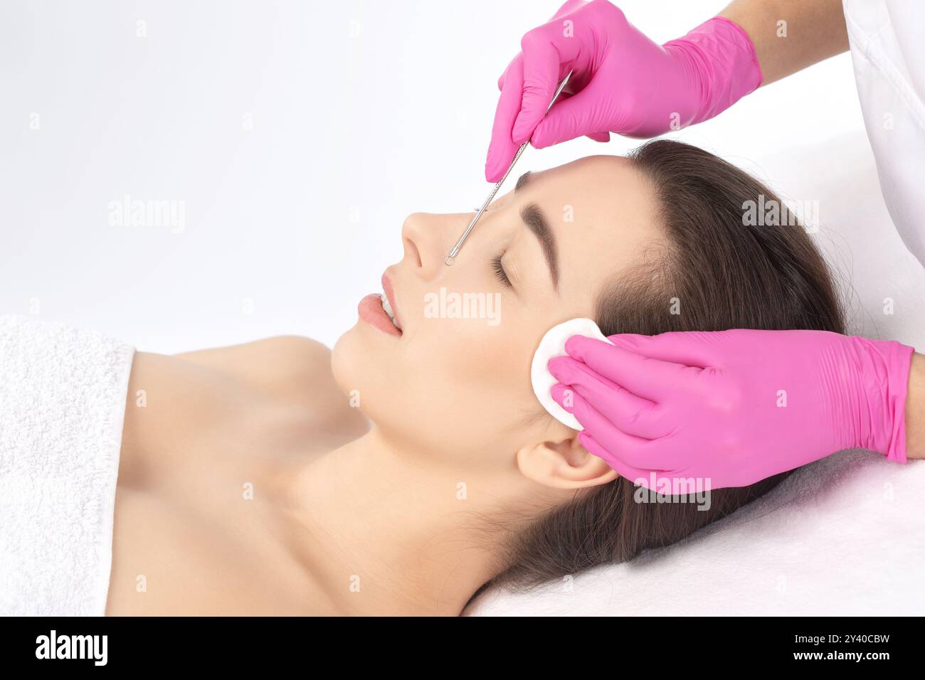 A procedure for cleansing the skin of the face from blackheads and acne ...