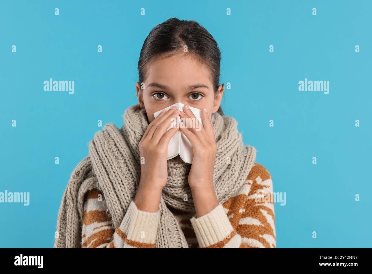 Cold symptom. Little girl with runny nose on light blue background ...