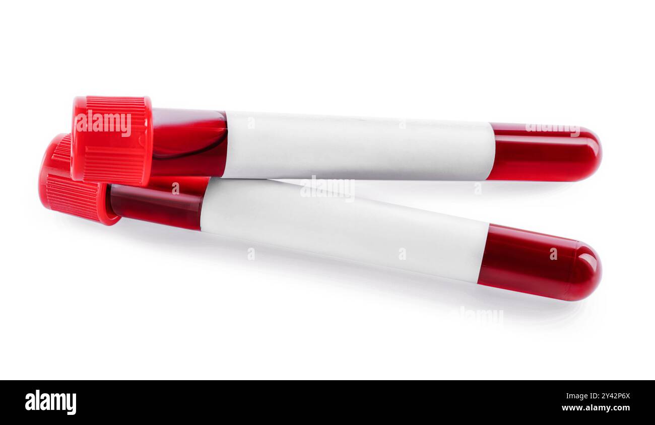 Blood in test tubes with blank labels on white background. Medical ...