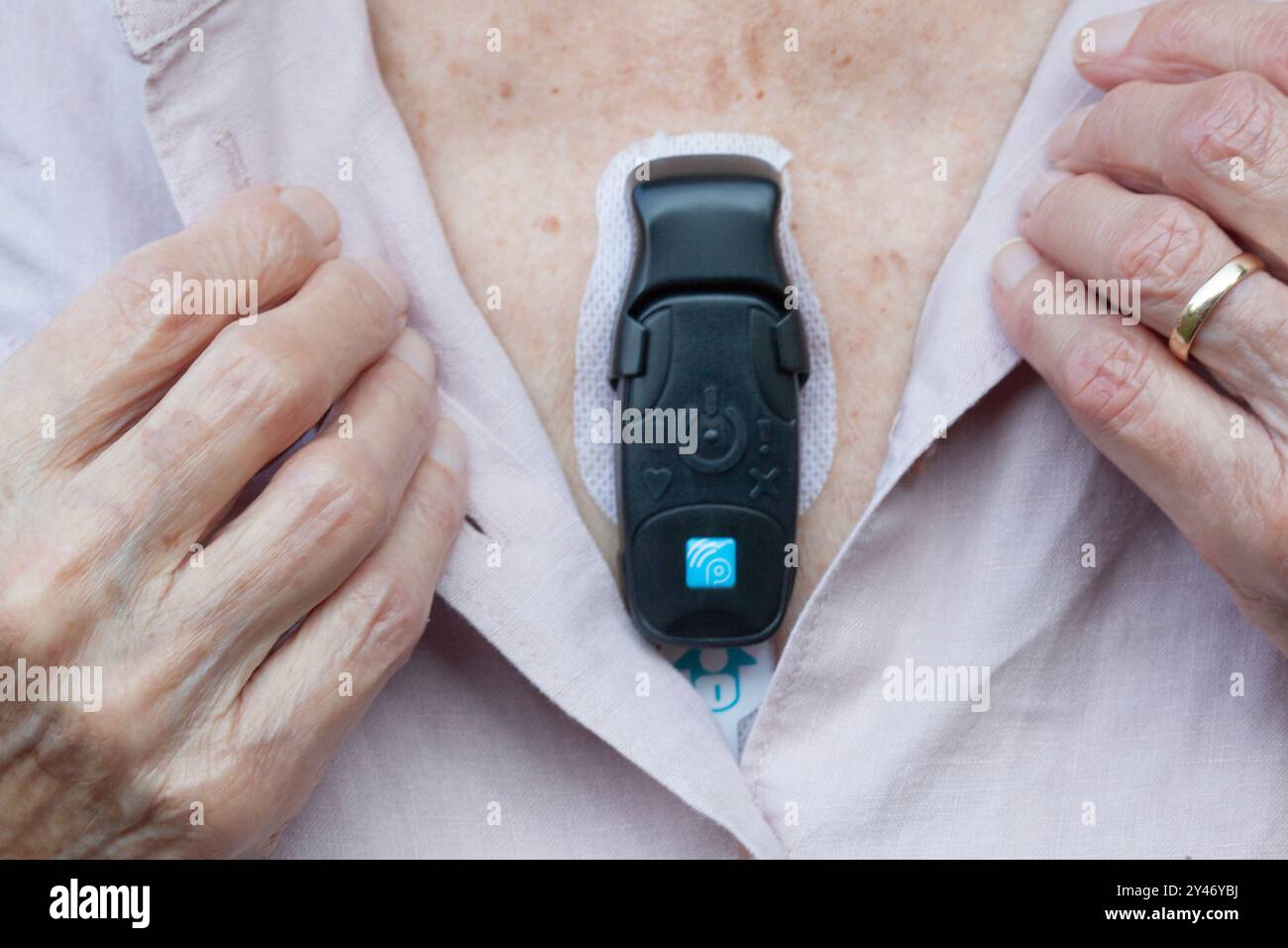 An 81-year old white woman wears a portable heart monitor as part of ...