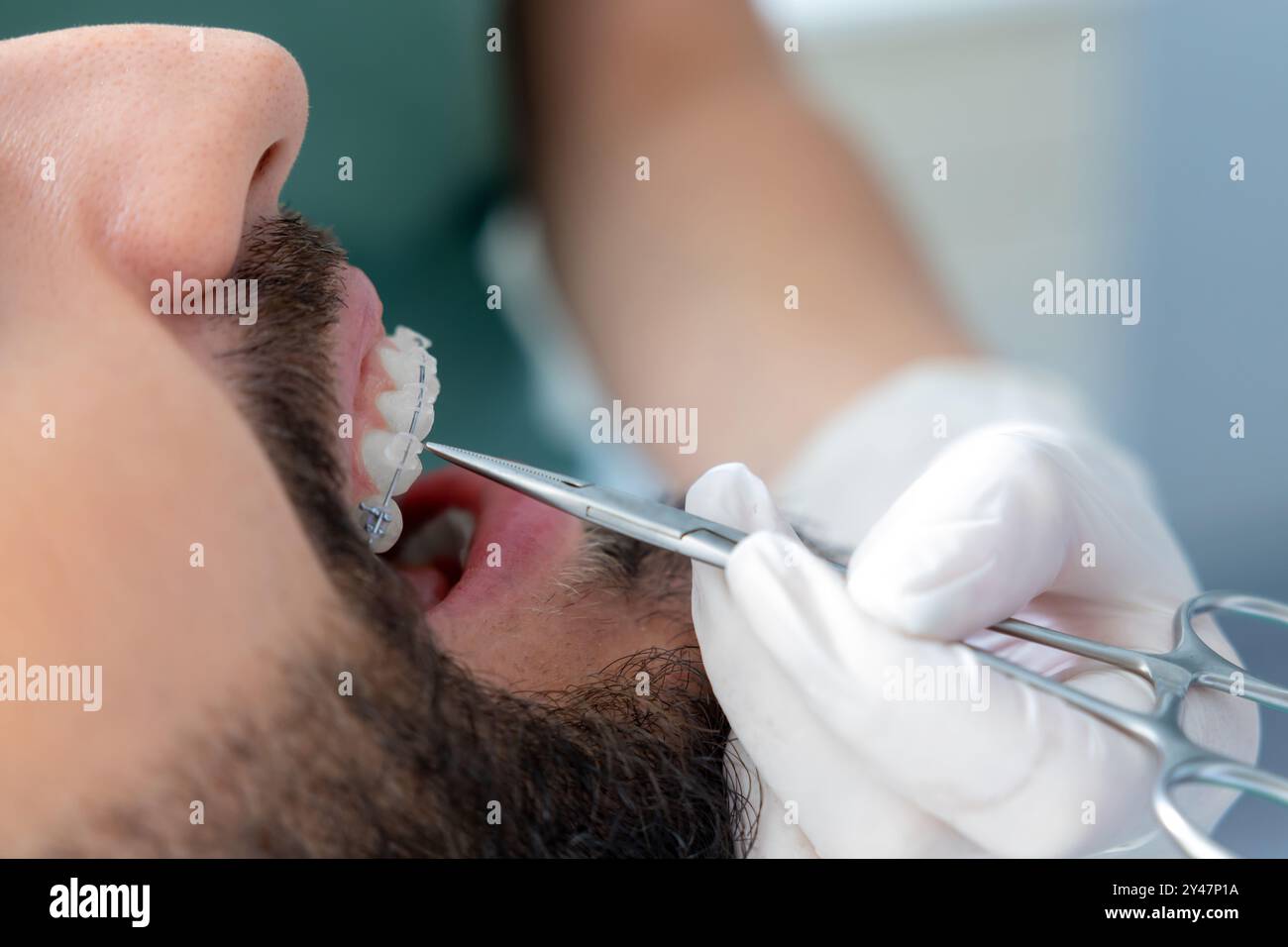 Professional mouth examination and dental treatment checkup in clinic ...