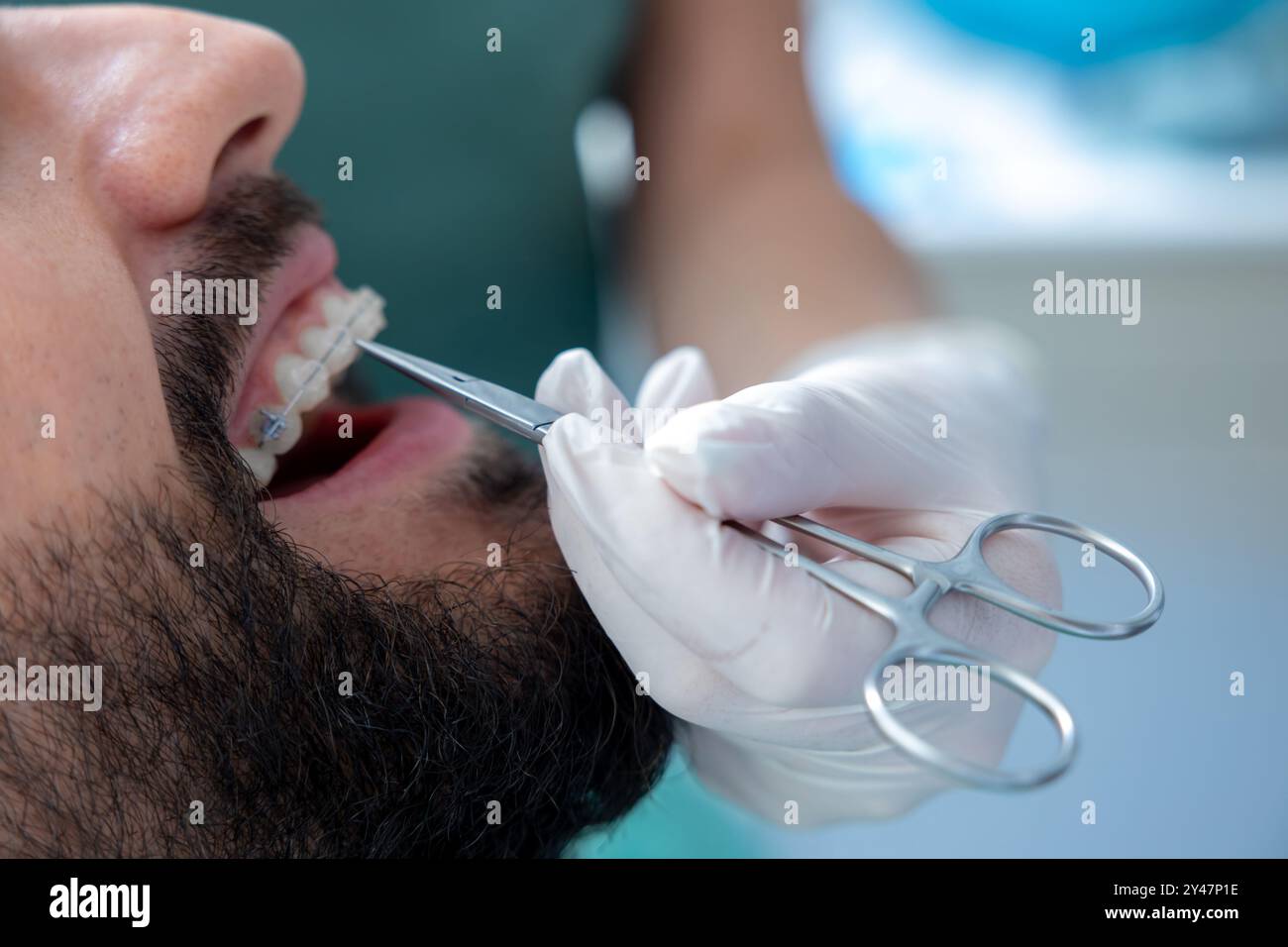 Doctor in clinic conducting detailed tooth inspection Stock Photo - Alamy