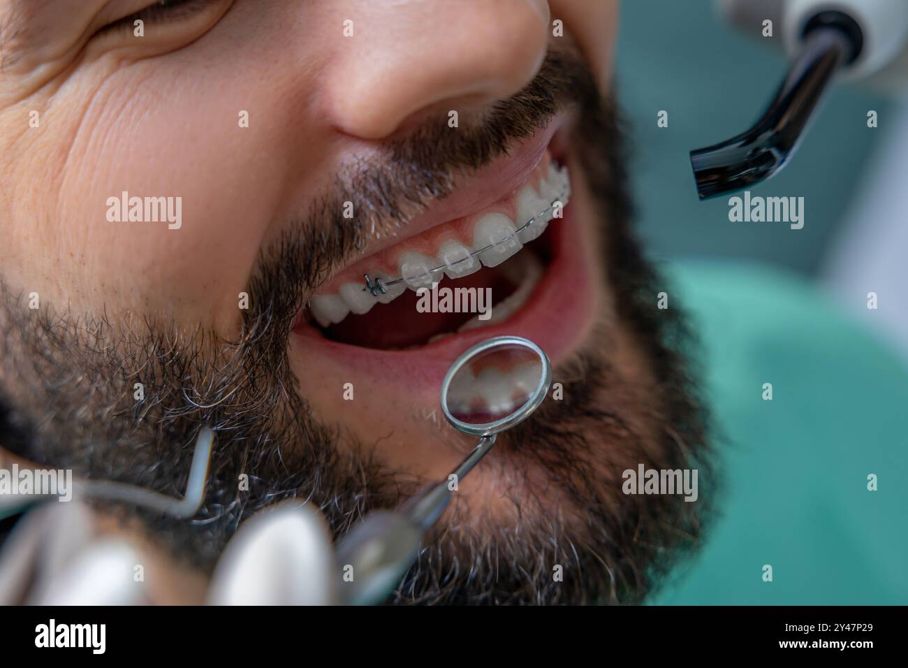 Doctor in clinic conducting detailed tooth inspection Stock Photo - Alamy