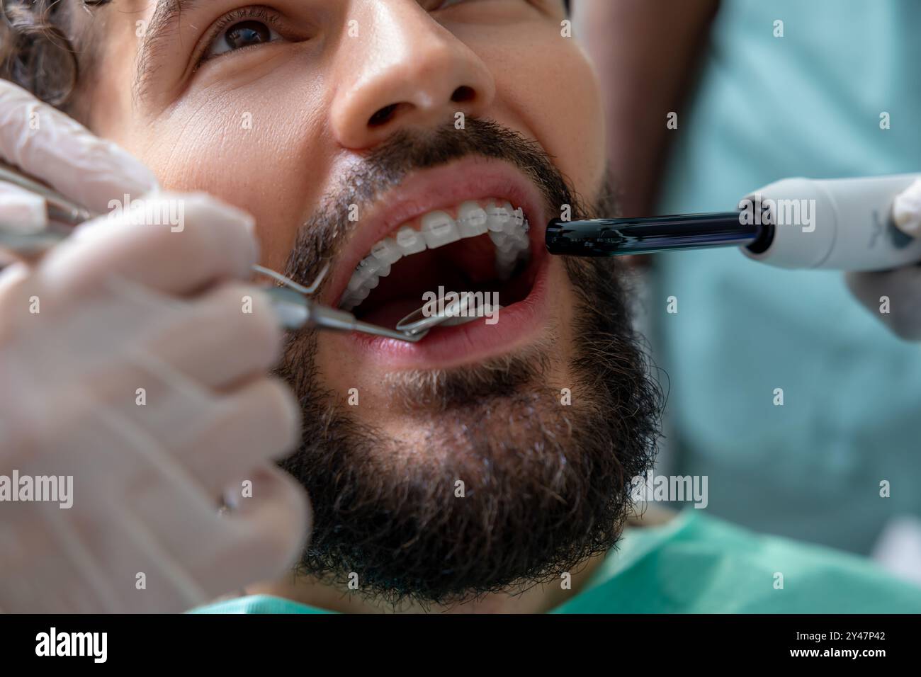 Doctor in clinic conducting detailed tooth inspection Stock Photo - Alamy