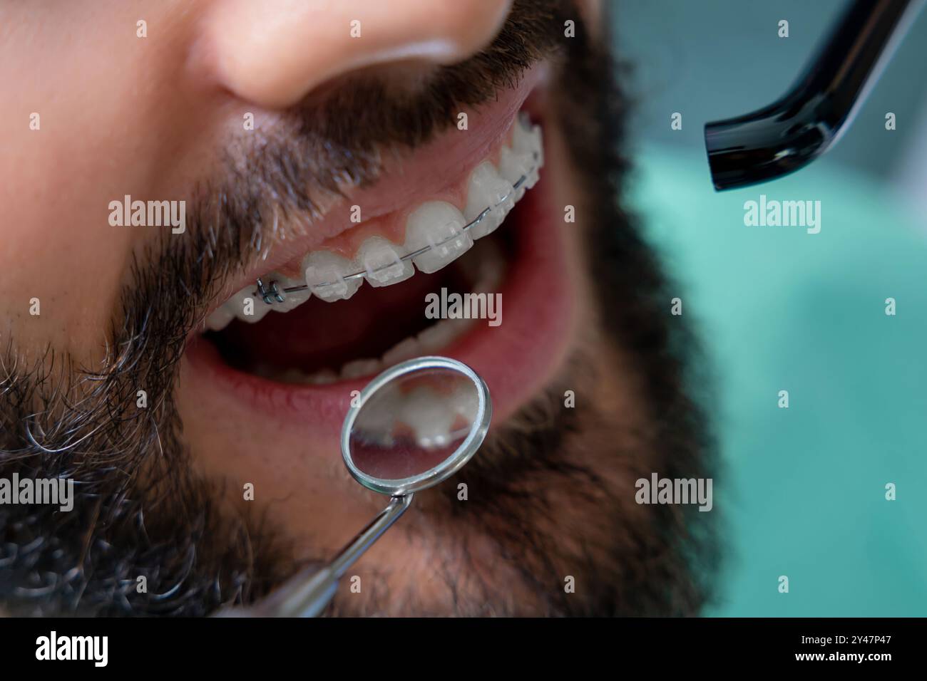 Doctor in clinic conducting detailed tooth inspection Stock Photo - Alamy