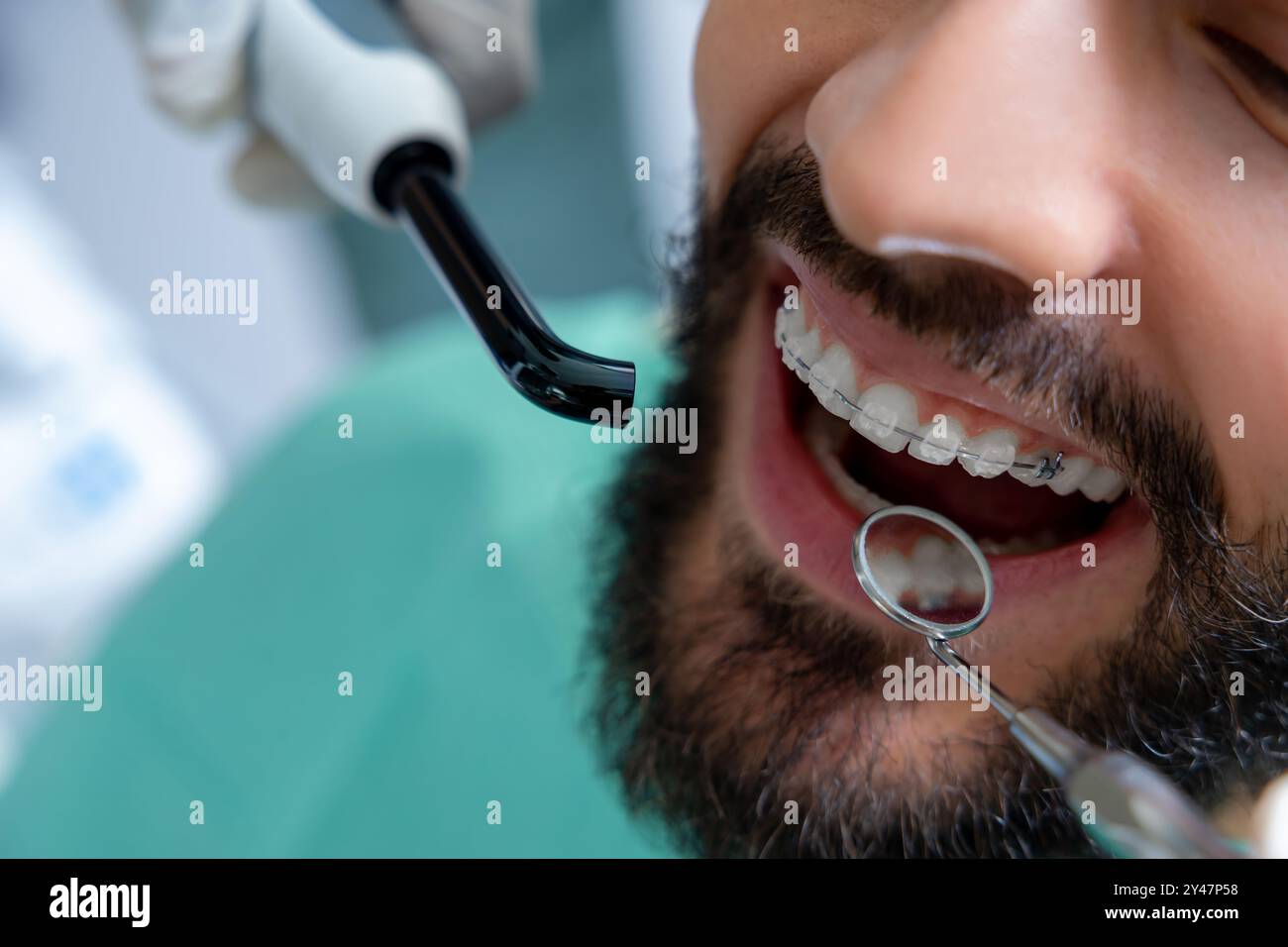 Professional mouth examination and dental treatment checkup in clinic ...