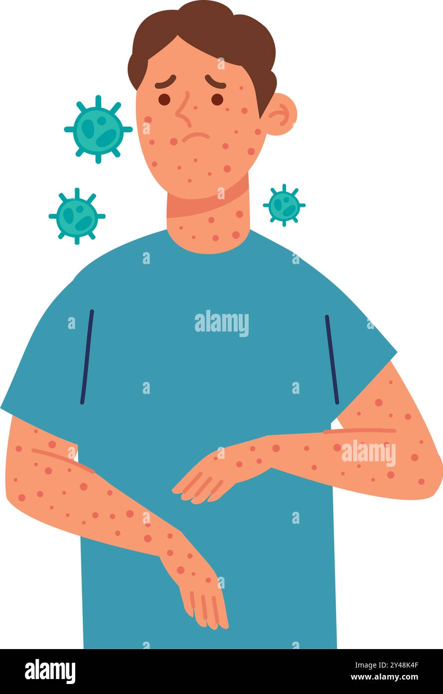 male character with monkeypox virus Stock Vector Image & Art - Alamy