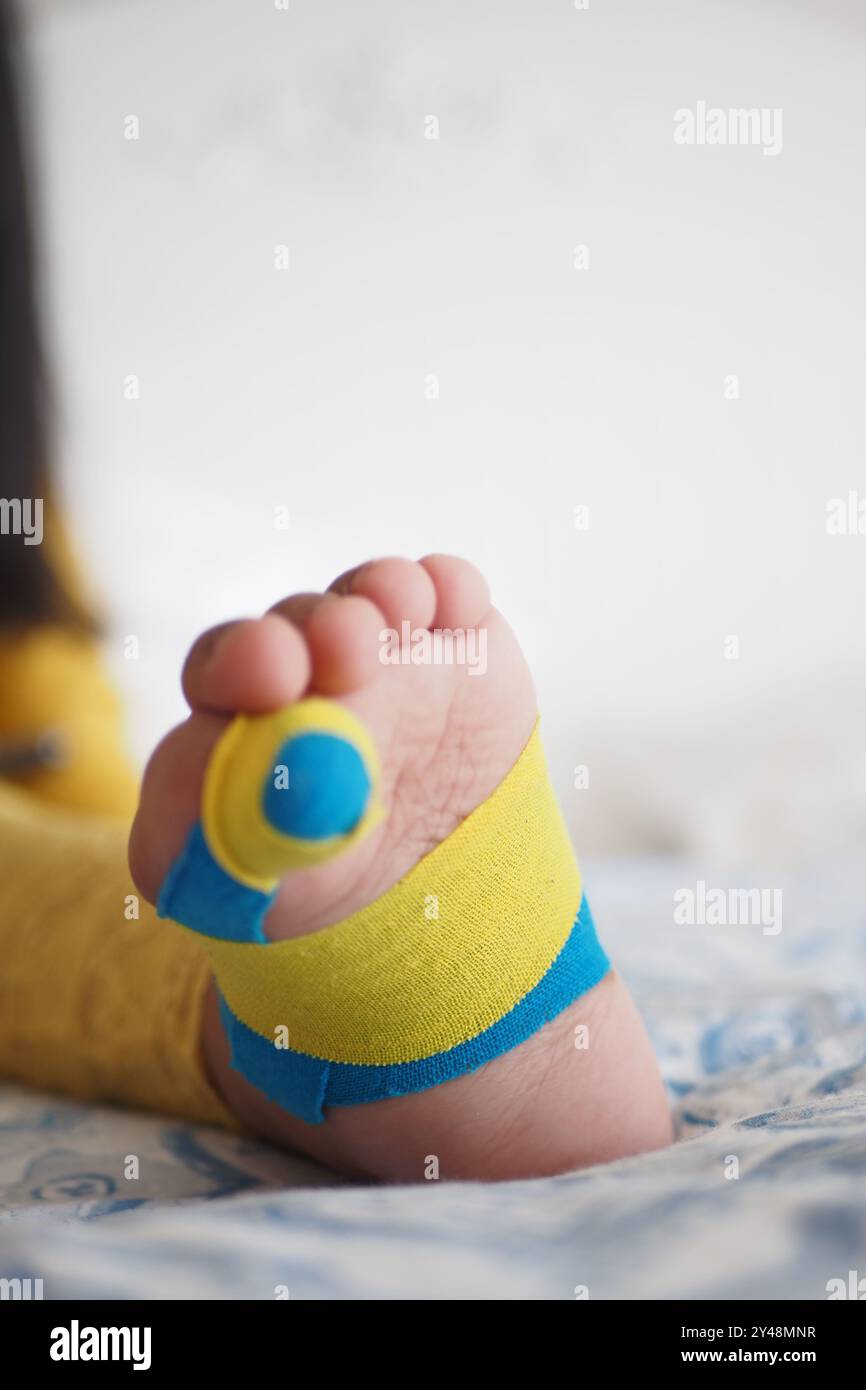 Elastic therapeutic blue tape applied to child leg. Kinesio Taping ...