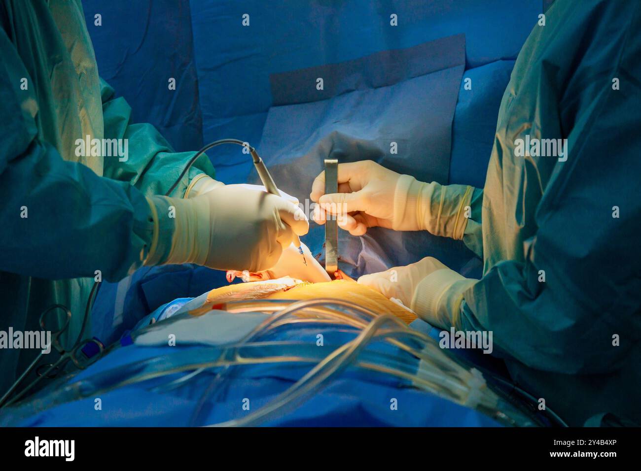 Surgeons prepare patient for surgery on operating table before ...