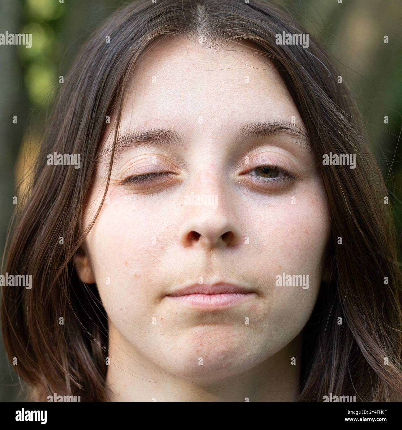 Portrait of a beautiful woman with a half closed eye affected by ...
