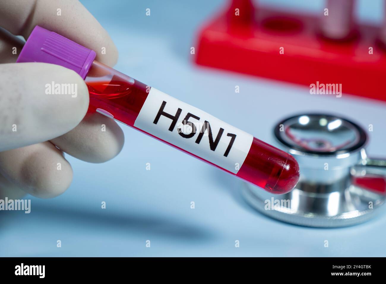 Blood collection tubes H5N1 test positive results,Medical health ...