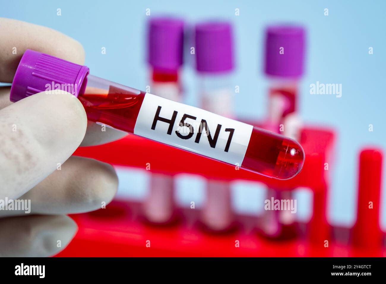 Blood collection tubes H5N1 test positive results,Medical health ...