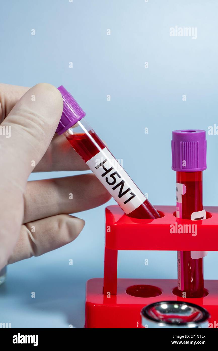 Blood collection tubes H5N1 test positive results,Medical health ...