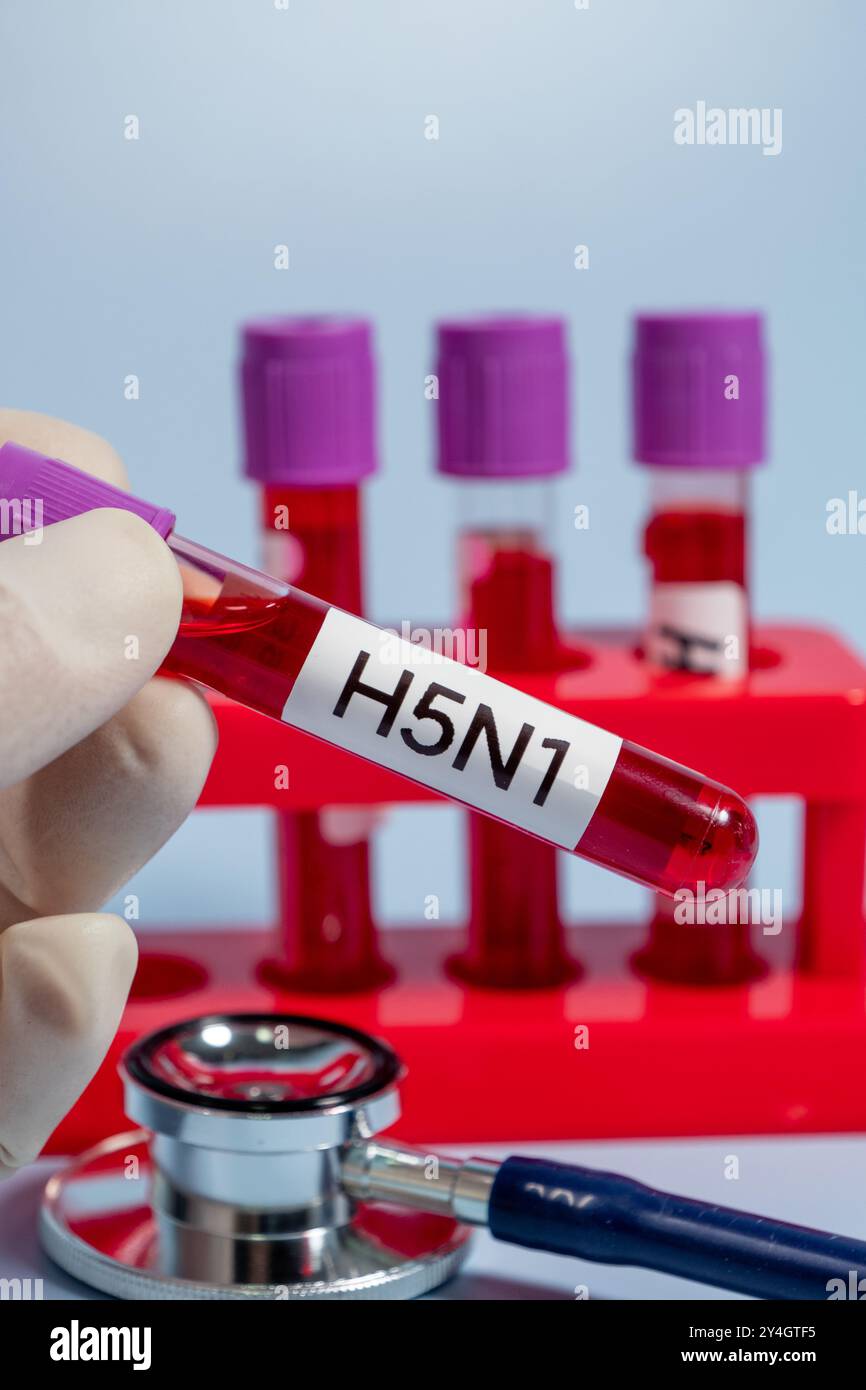 Blood collection tubes H5N1 test positive results,Medical health ...