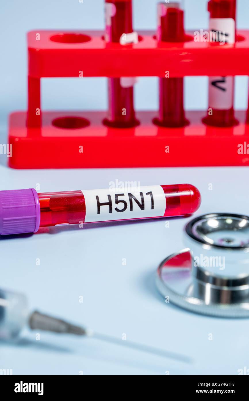 Blood collection tubes H5N1 test positive results,Medical health ...