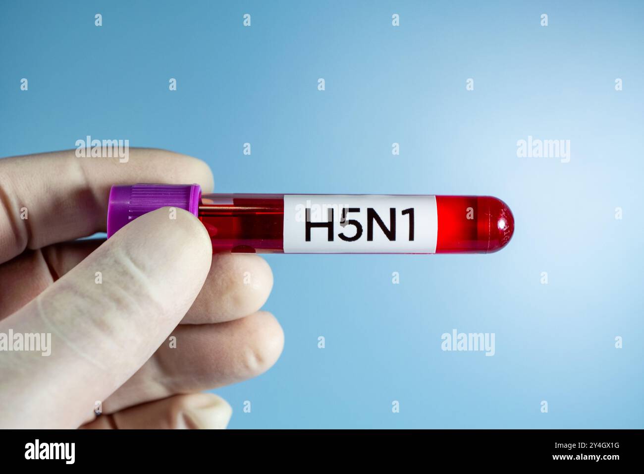 Respiratory system bird hi-res stock photography and images - Alamy