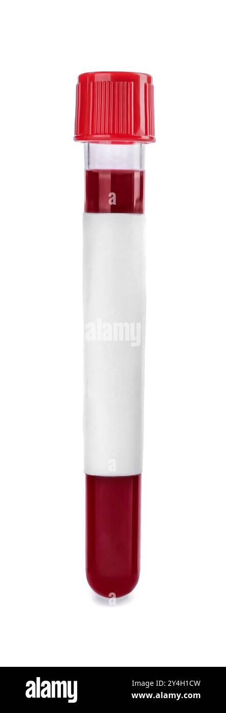 Blood in test tube with blank label on white background. Medical ...