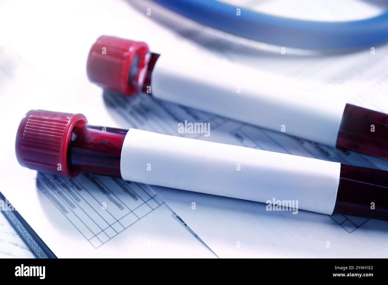 Blood in test tubes with blank labels on medical forms, closeup ...