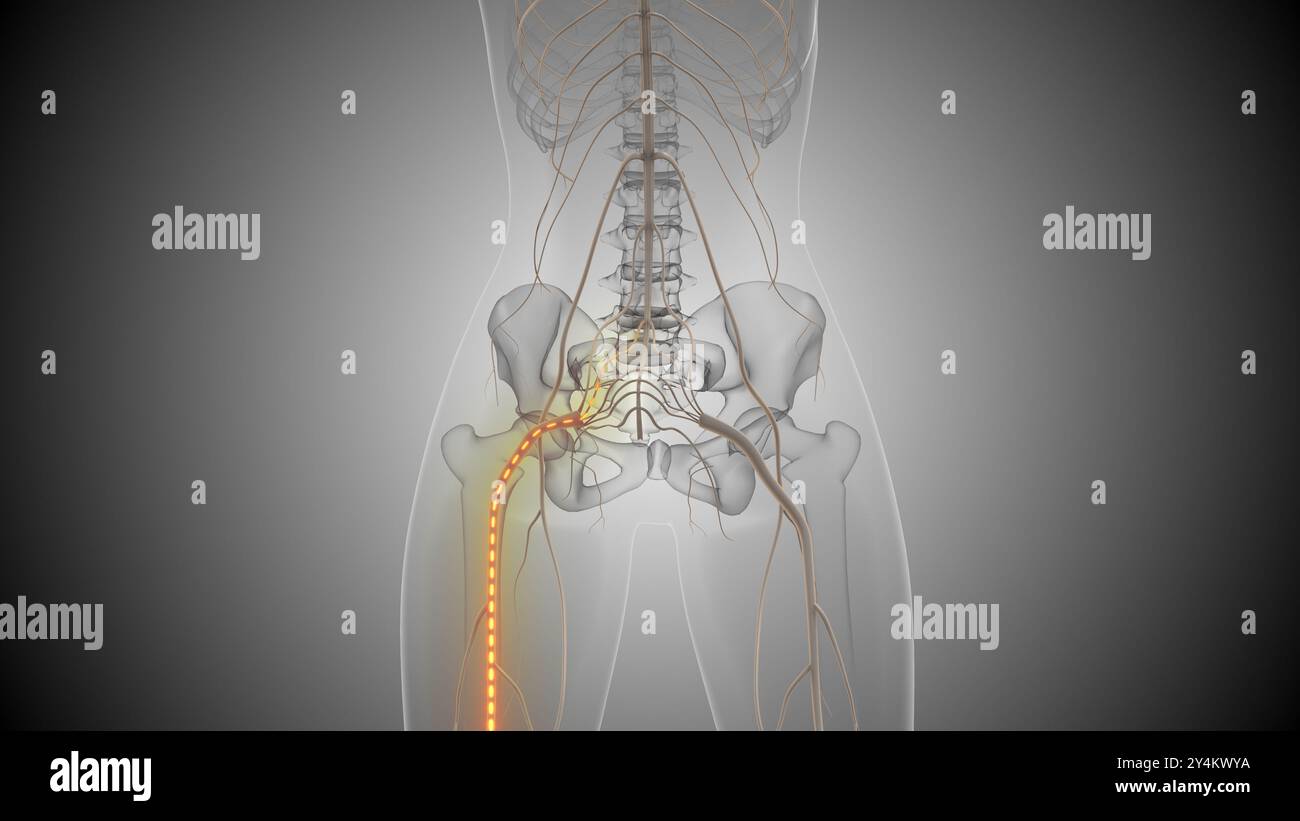 Sciatica pain anatomy hi-res stock photography and images - Alamy