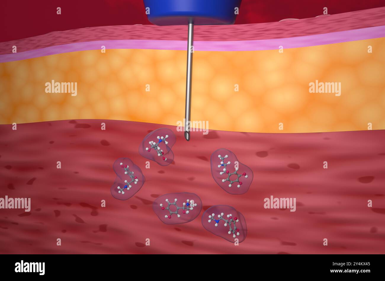 Epinephrine (adrenaline) inject - closeup view 3d illustration Stock ...