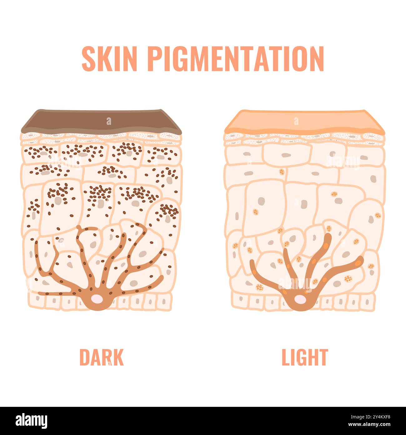 Human skin tone pigmentation diversity infographic diagram Stock Vector ...