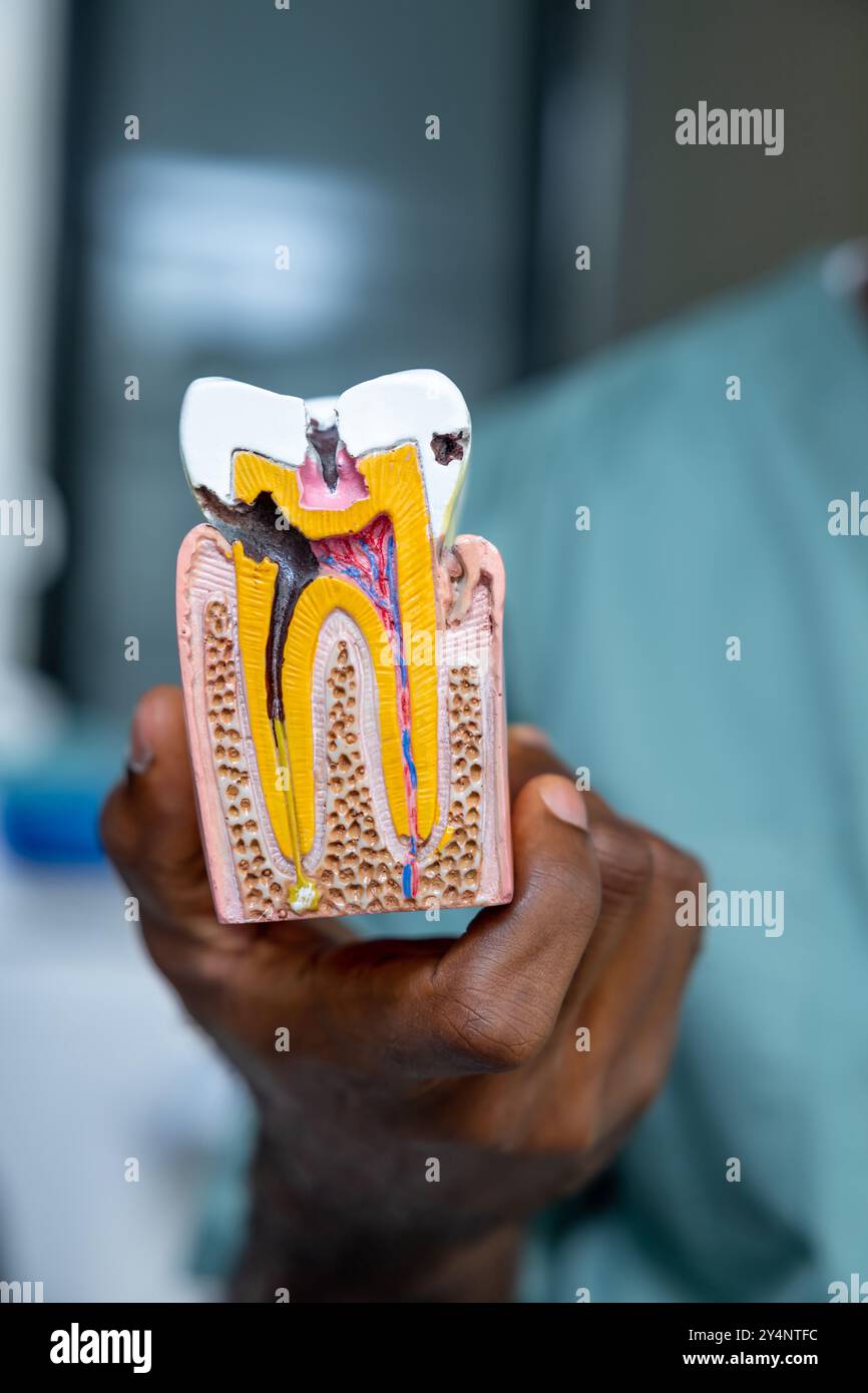 Model in the clinic displaying the structure of teeth, including enamel ...