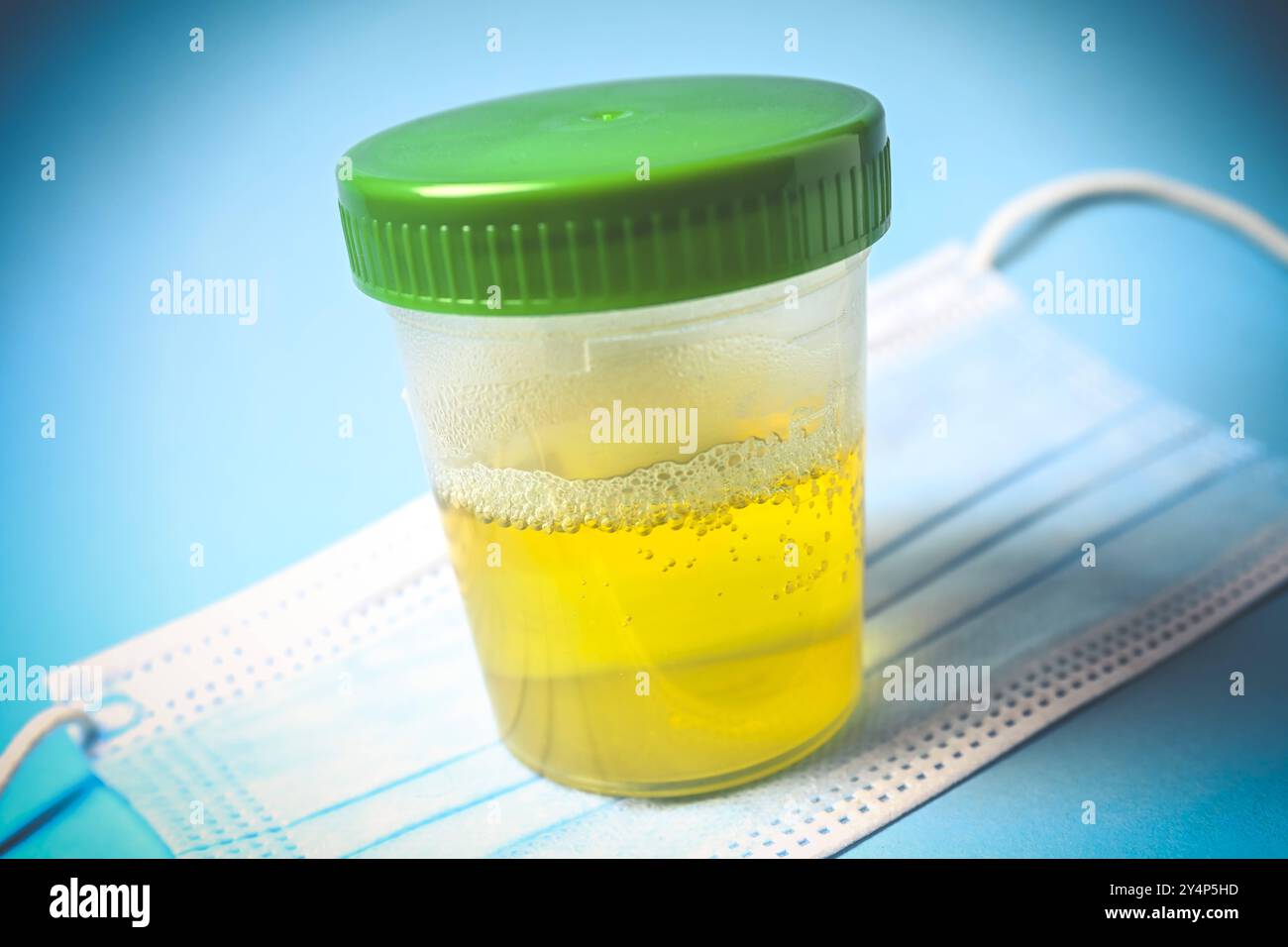 Urinprobe *** Urine sample Stock Photo - Alamy