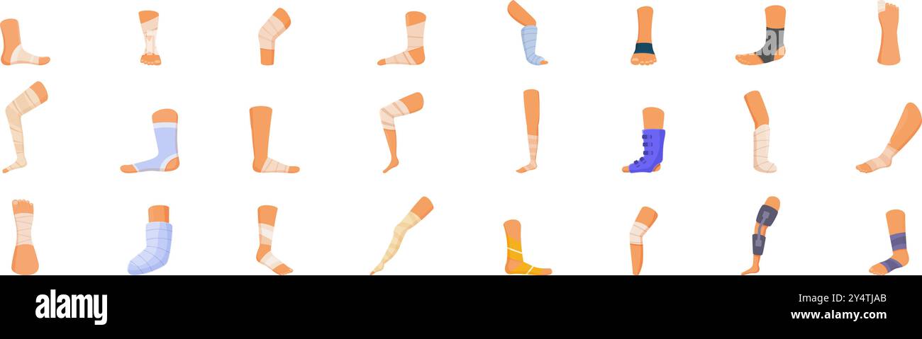 Bone fracture types hi-res stock photography and images - Alamy