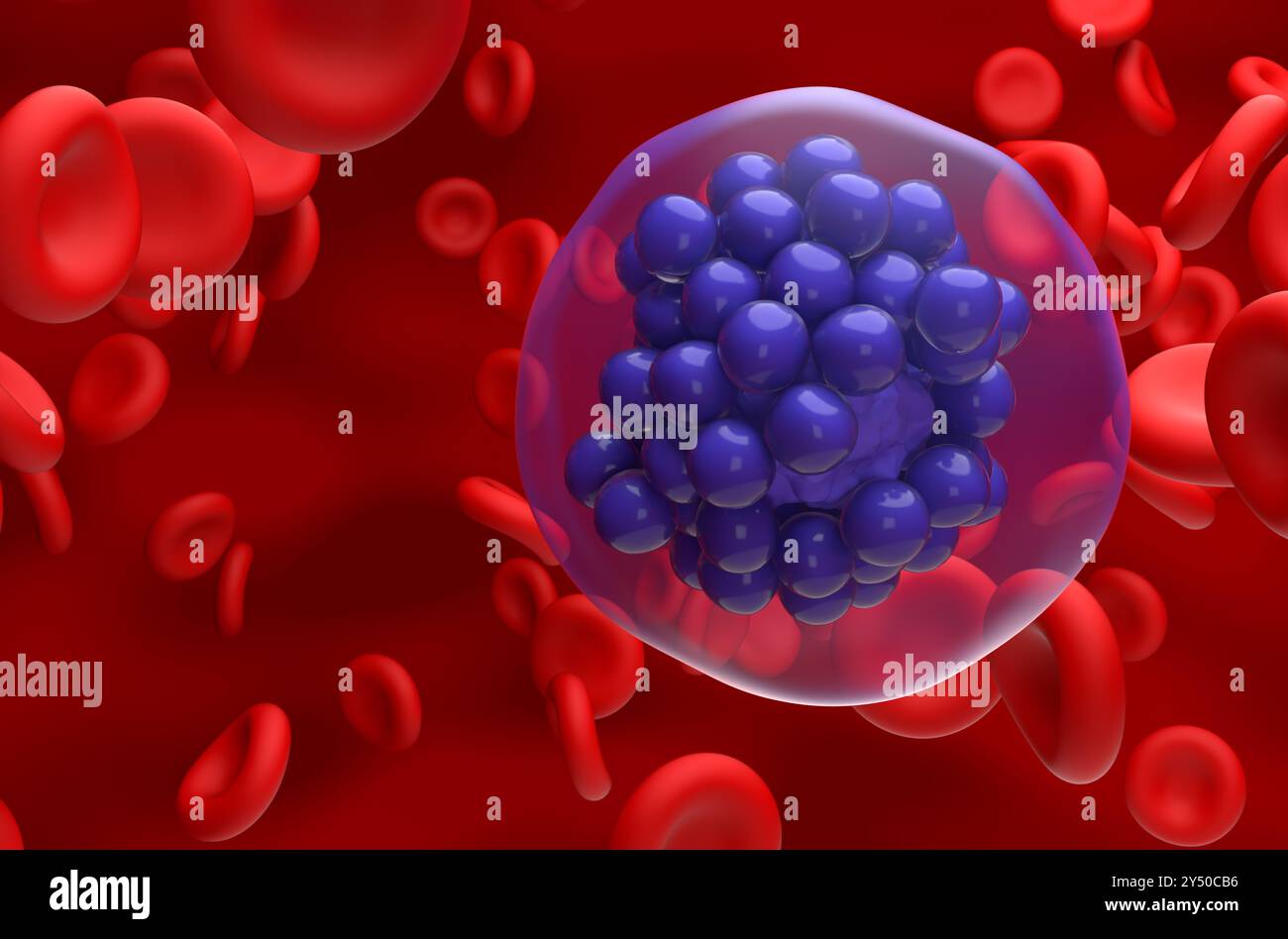 Diffuse large B-cell lymphoma (DLBCL) - closeup view 3d illustration ...
