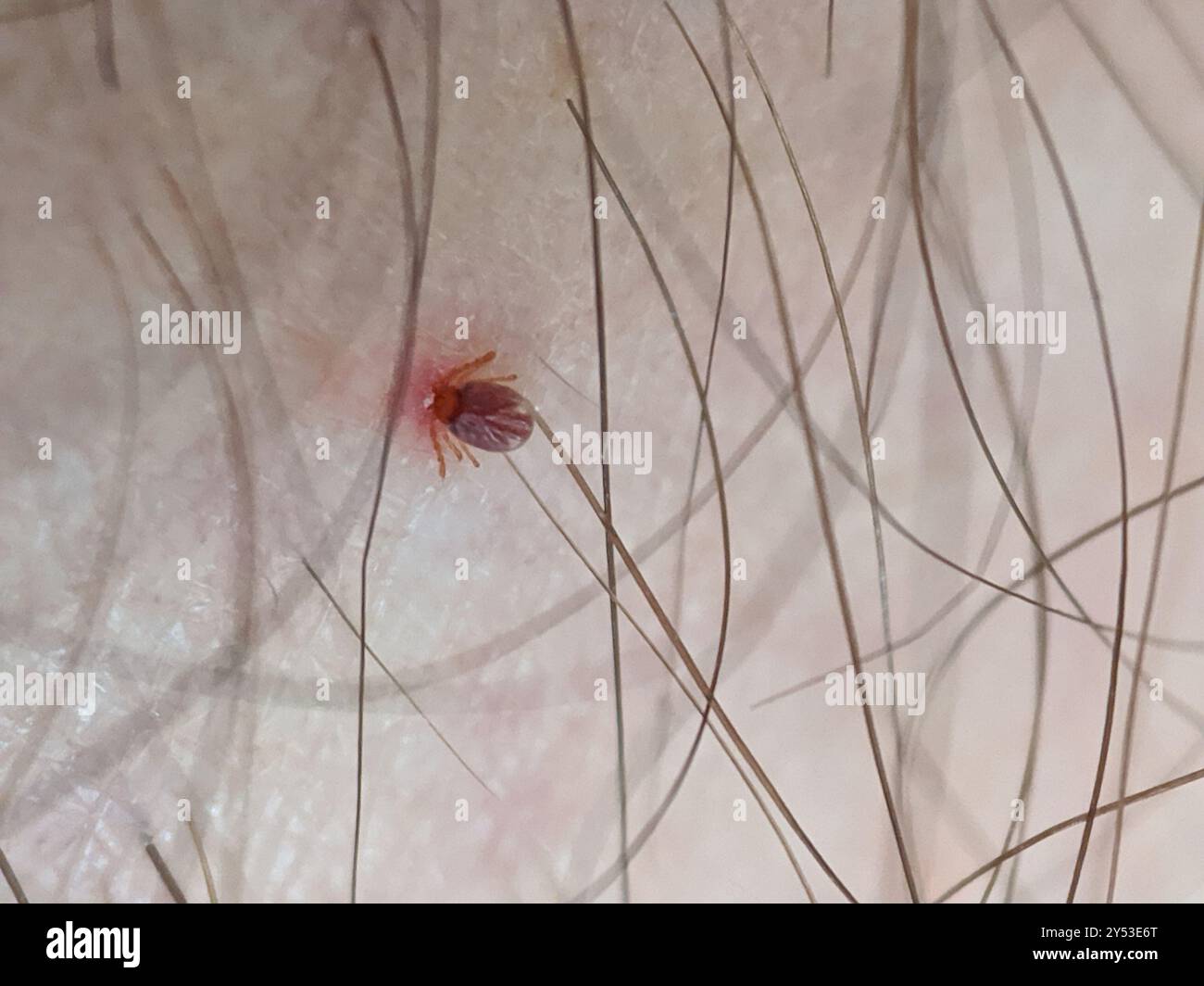 Ticks (Ixodida) Arachnida Stock Photo - Alamy