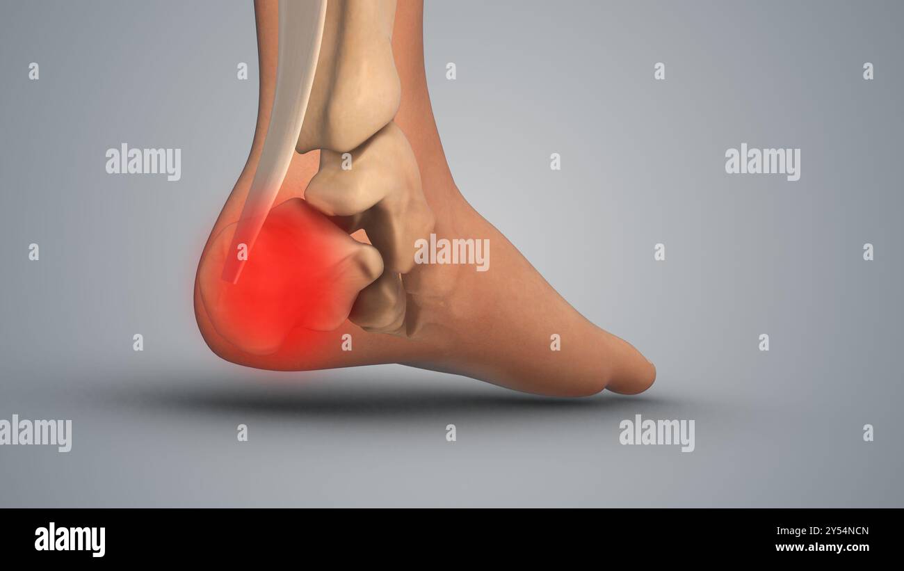 Human heel anatomy hi-res stock photography and images - Alamy