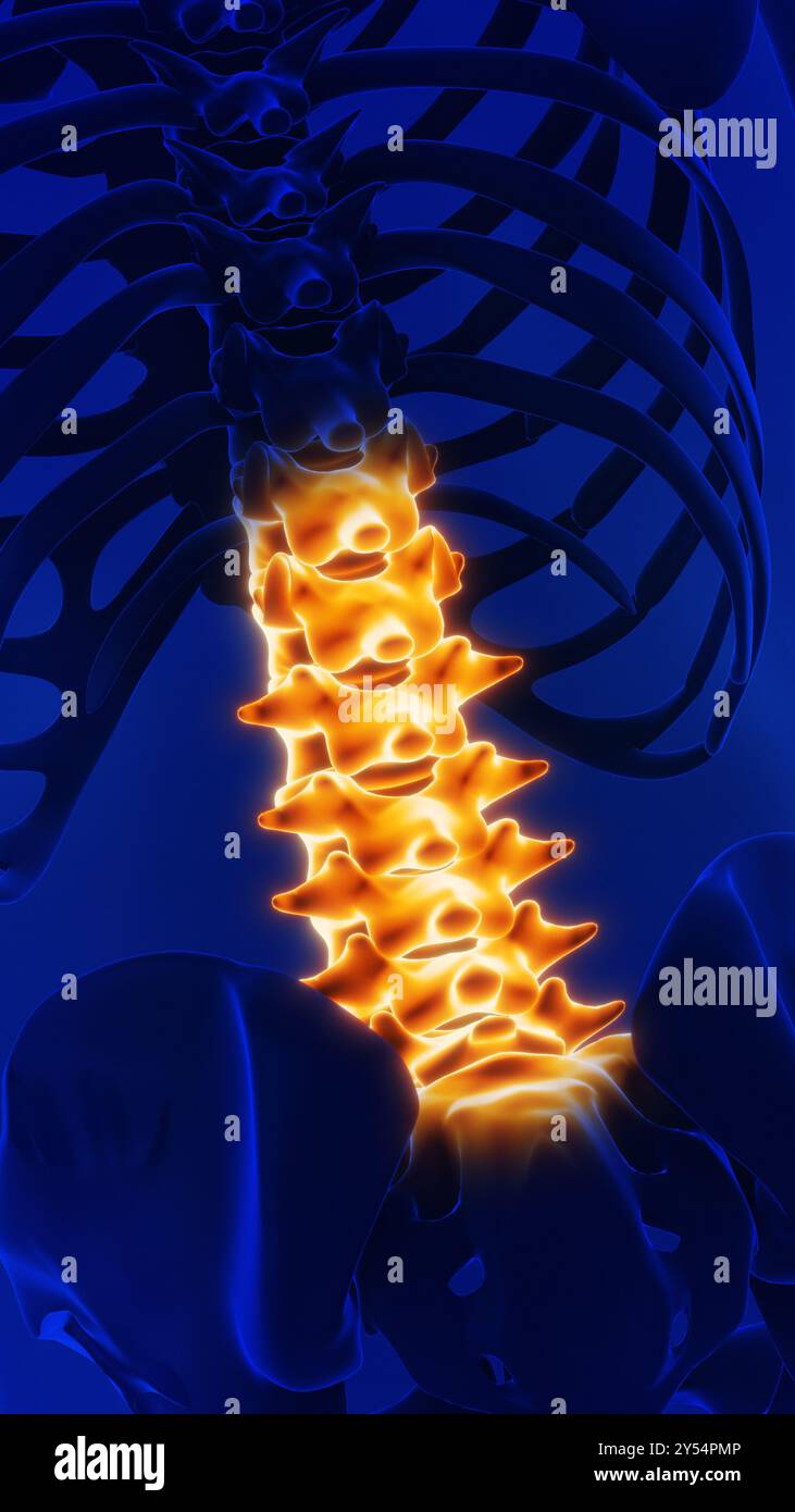 Human Lifting heavy object resulting Lower back Pain Stock Photo - Alamy