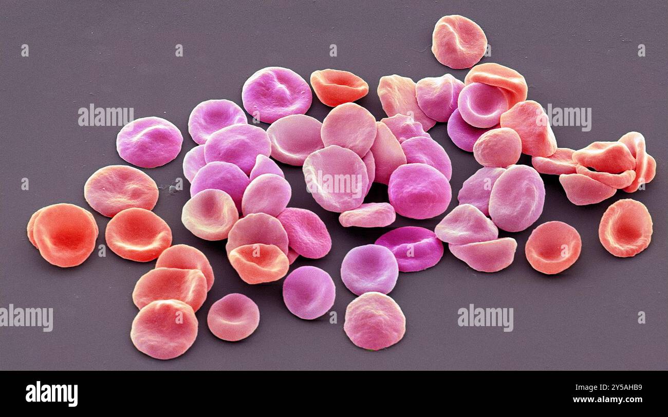 Red blood cells. Coloured scanning electron micrograph (SEM) of red ...