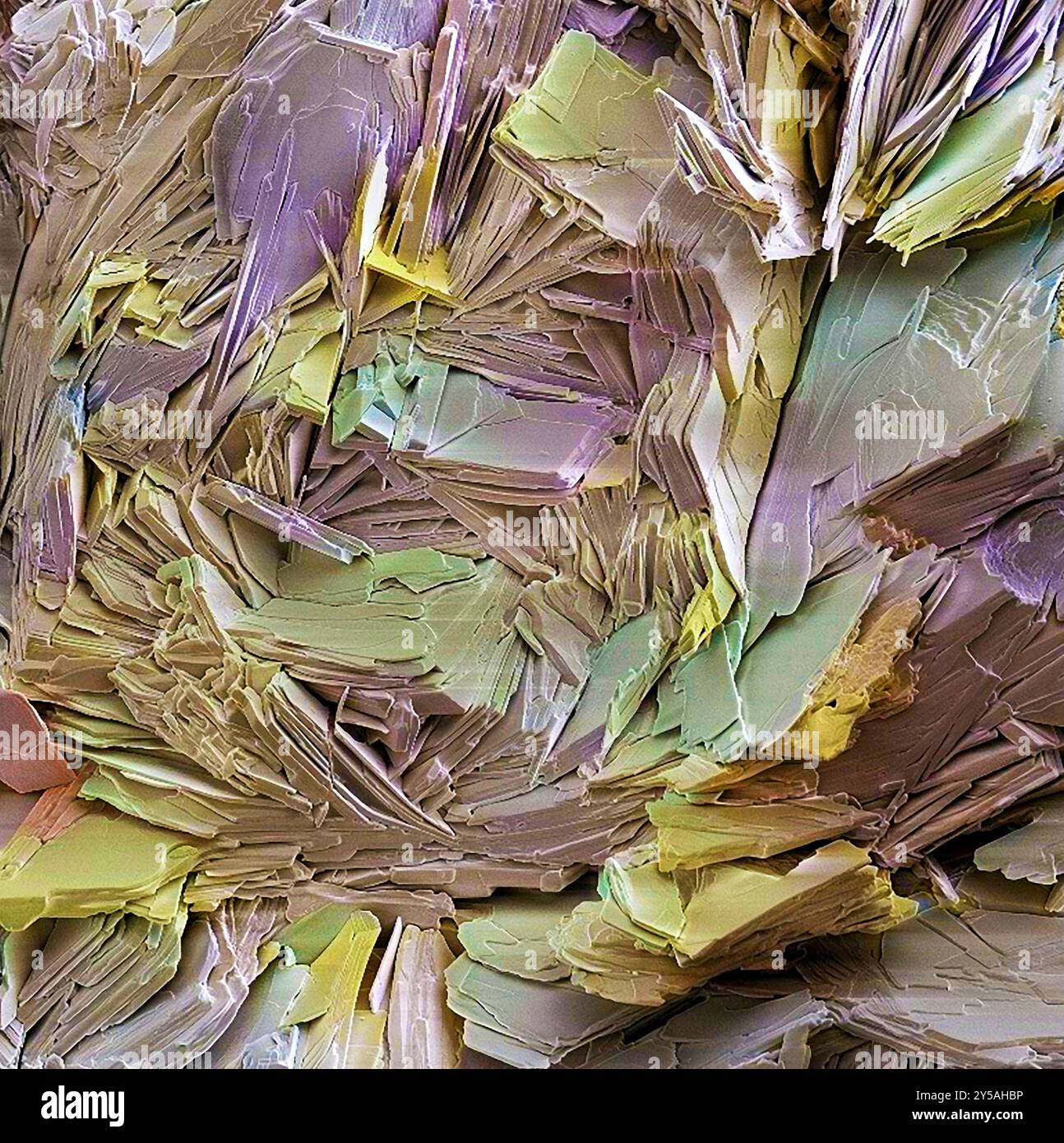 Gallstone crystals. Coloured scanning electron micrograph (SEM) of the ...