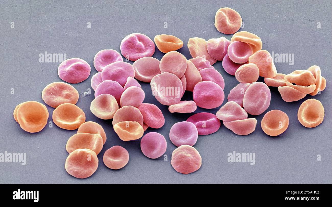 Biconcave Disc RED BLOOD CELLS ARE BICONCAVE
