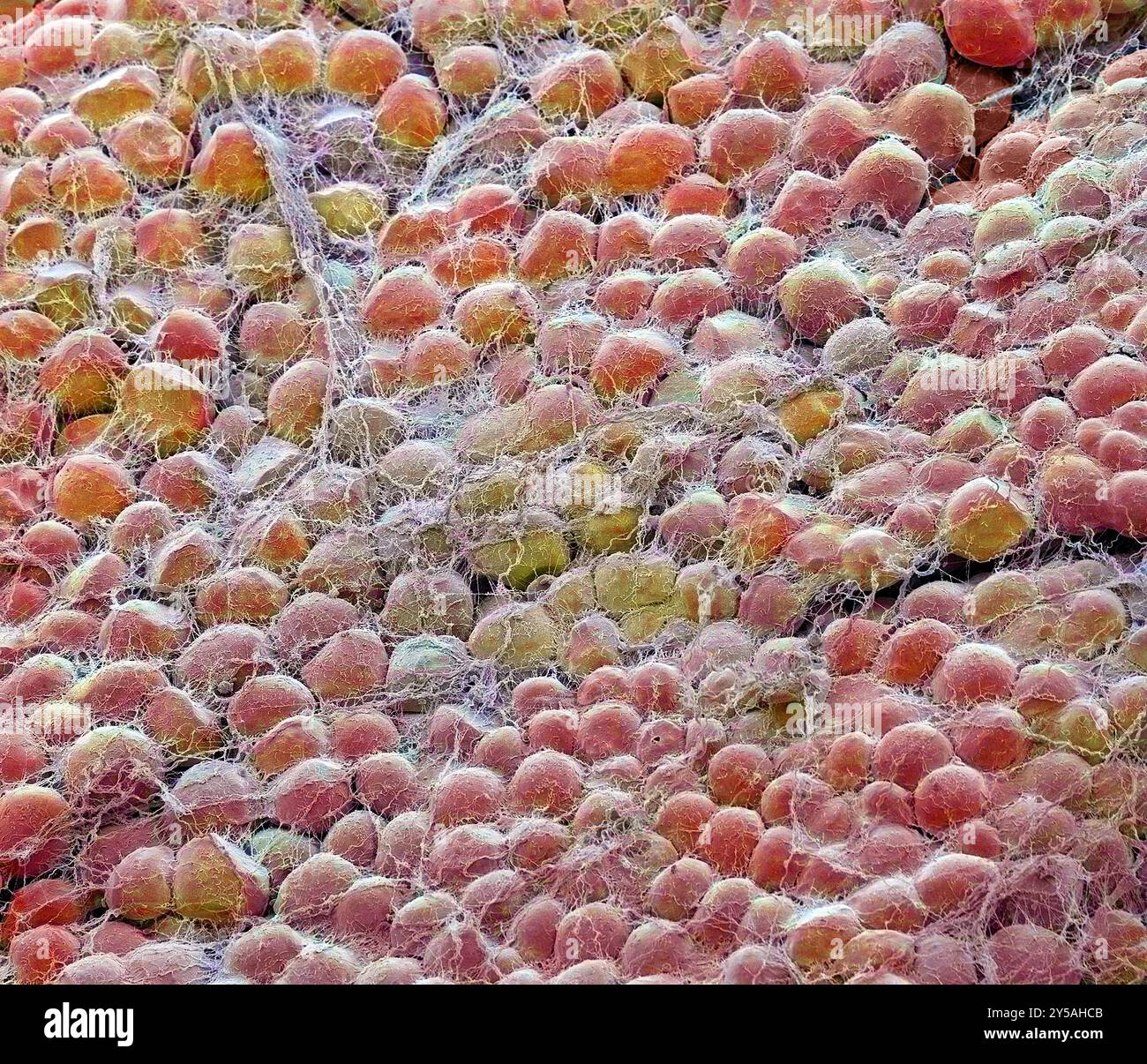 Fat cells. Coloured scanning electron micrograph (SEM) of joined fat ...