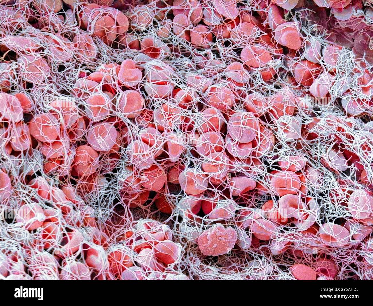 Structure of erythrocytes micrograph hi-res stock photography and ...