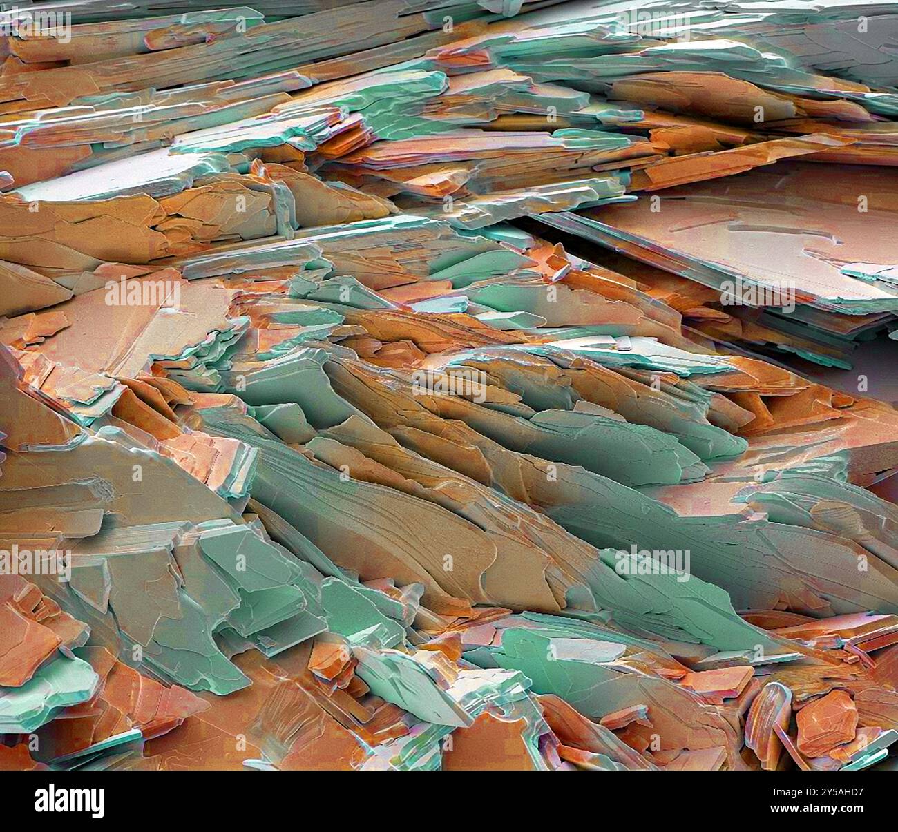 Gallstone crystals. Coloured scanning electron micrograph (SEM) of the ...